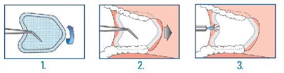 Absorvente de saliva NeoDrys | Labordental