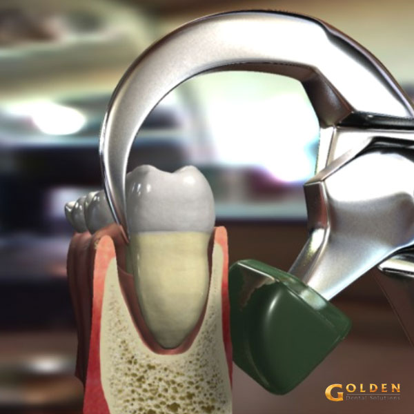 Instrumentos para exodontia Physics Forceps | Labordental