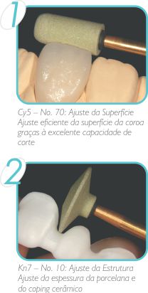 duragreen-dia-passo1e2 - Labordental - Transformando o sorriso em estilo de vida ;)