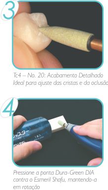 duragreen-dia-passo3e4 - Labordental - Transformando o sorriso em estilo de vida ;)