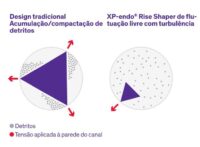 Instrumentos de preparo XP-endo Rise Shaper | Labordental