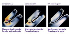 Instrumentos de preparo XP-endo Rise Shaper | Labordental